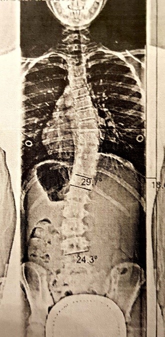 Success Stories – Active Spine Physical Therapy